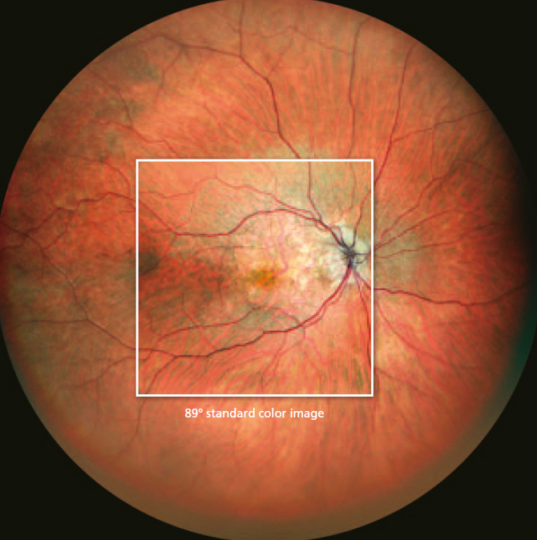 Nidek Mirante SLO OCT