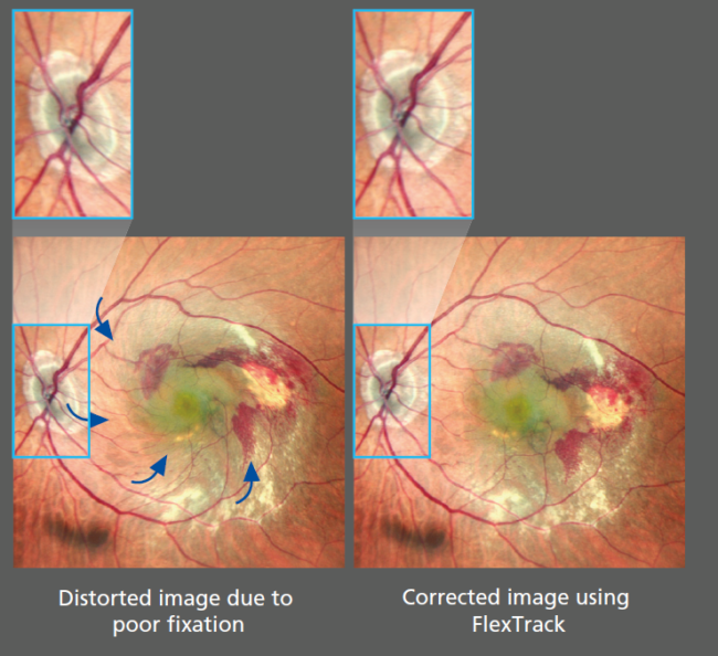 NIDEK Mirante Multi Modal OCT-A