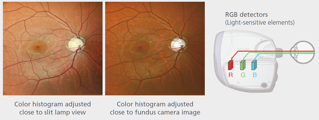 NIDEK Mirante SLO/OCT | Saturn Optical