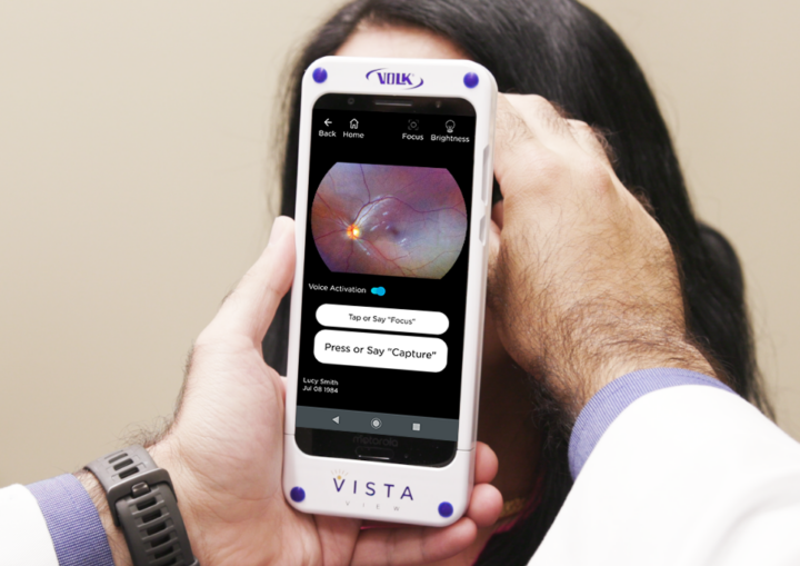 Volk VistaView™ Portable Retinal Camera