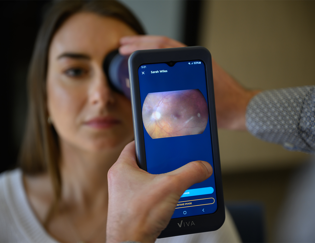 Volk Viva – the all-in-one imaging solution